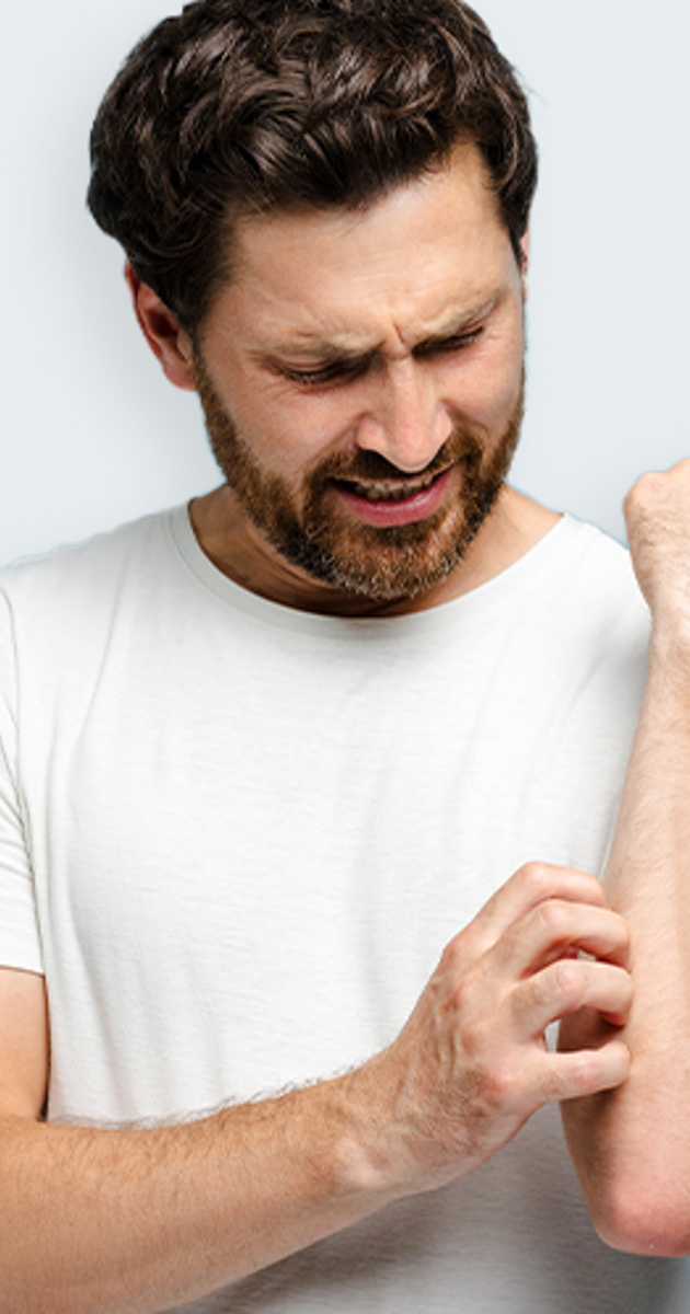 Dermatite atopica | Funziona Srl